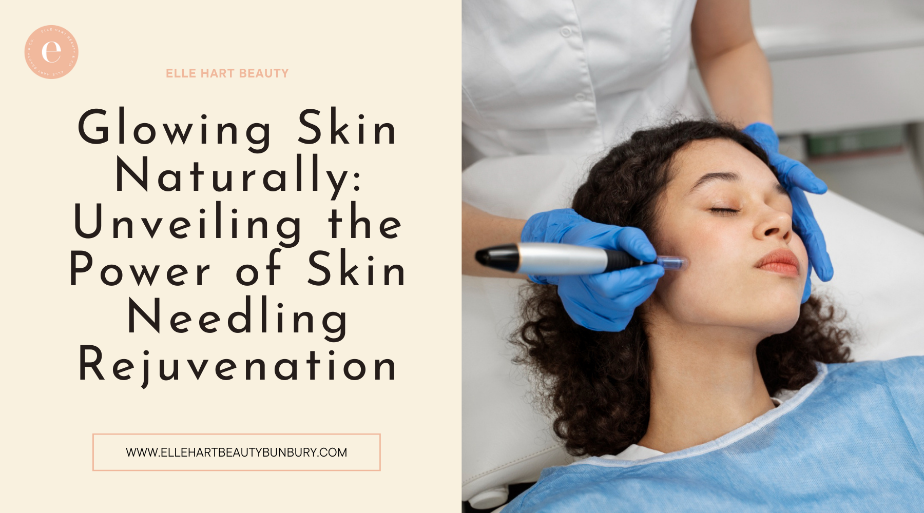 Glowing Skin Naturally: Unveiling the Power of Skin Needling ...